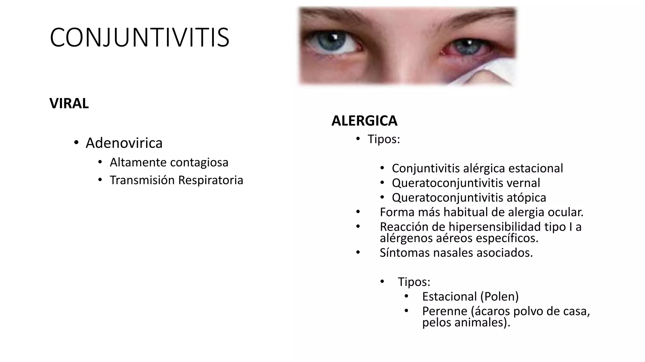 Conjuntiva 1 | PPT