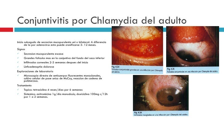 Conjuntiva