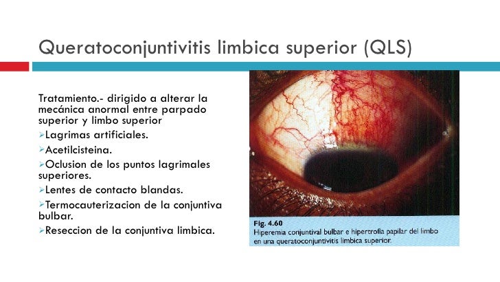 Conjuntiva