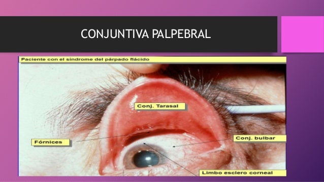 Anatomia y valoracion de la conjuntiva.
