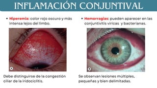Conjuntiva - Clínica de Ofatalmología 3.pdf