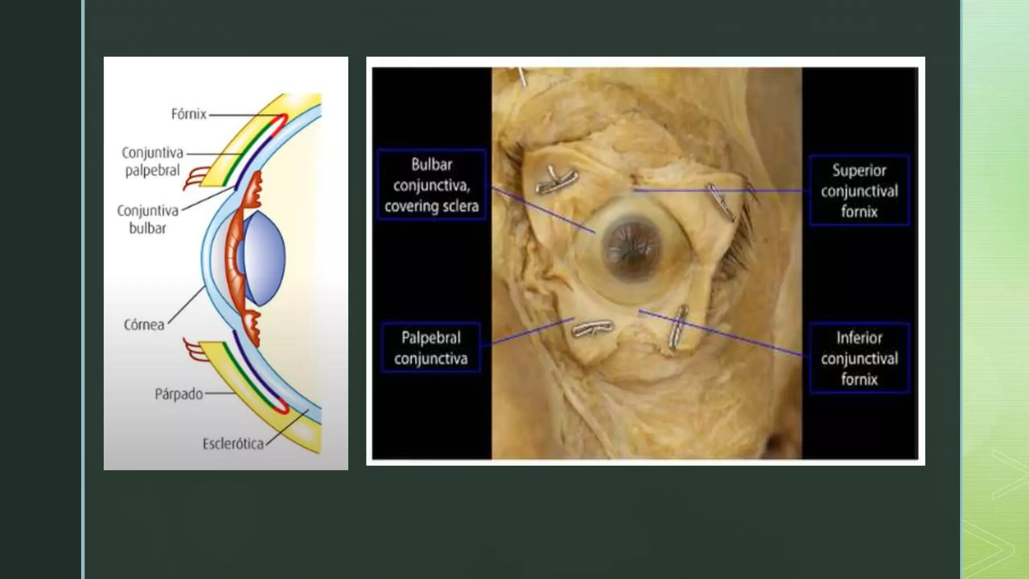 CONJUNTIVA, ESCLERA Y EPISCLERA.pptx