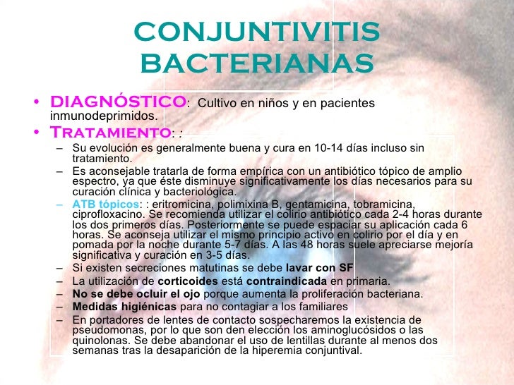 Conjuntivitis