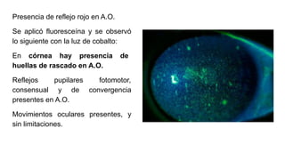 PRESENTACION CASO CLINICO CONJUNTIVITIS BACTERIANA | PDF