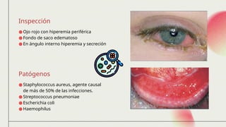 Exploración de la conjuntiva y Conjuntivitis.pptx