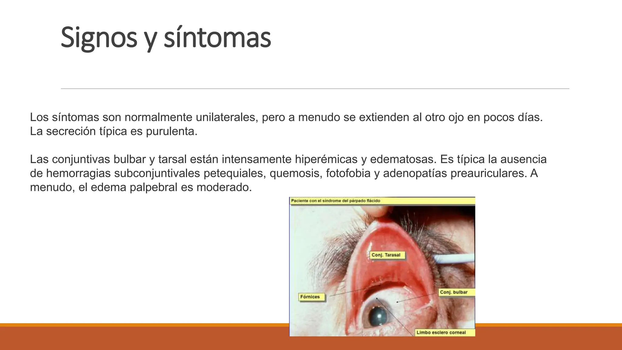 CONJUNTIVITIS-BACTERIANA-oftalmología.pptx