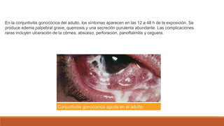 CONJUNTIVITIS-BACTERIANA-oftalmología.pptx