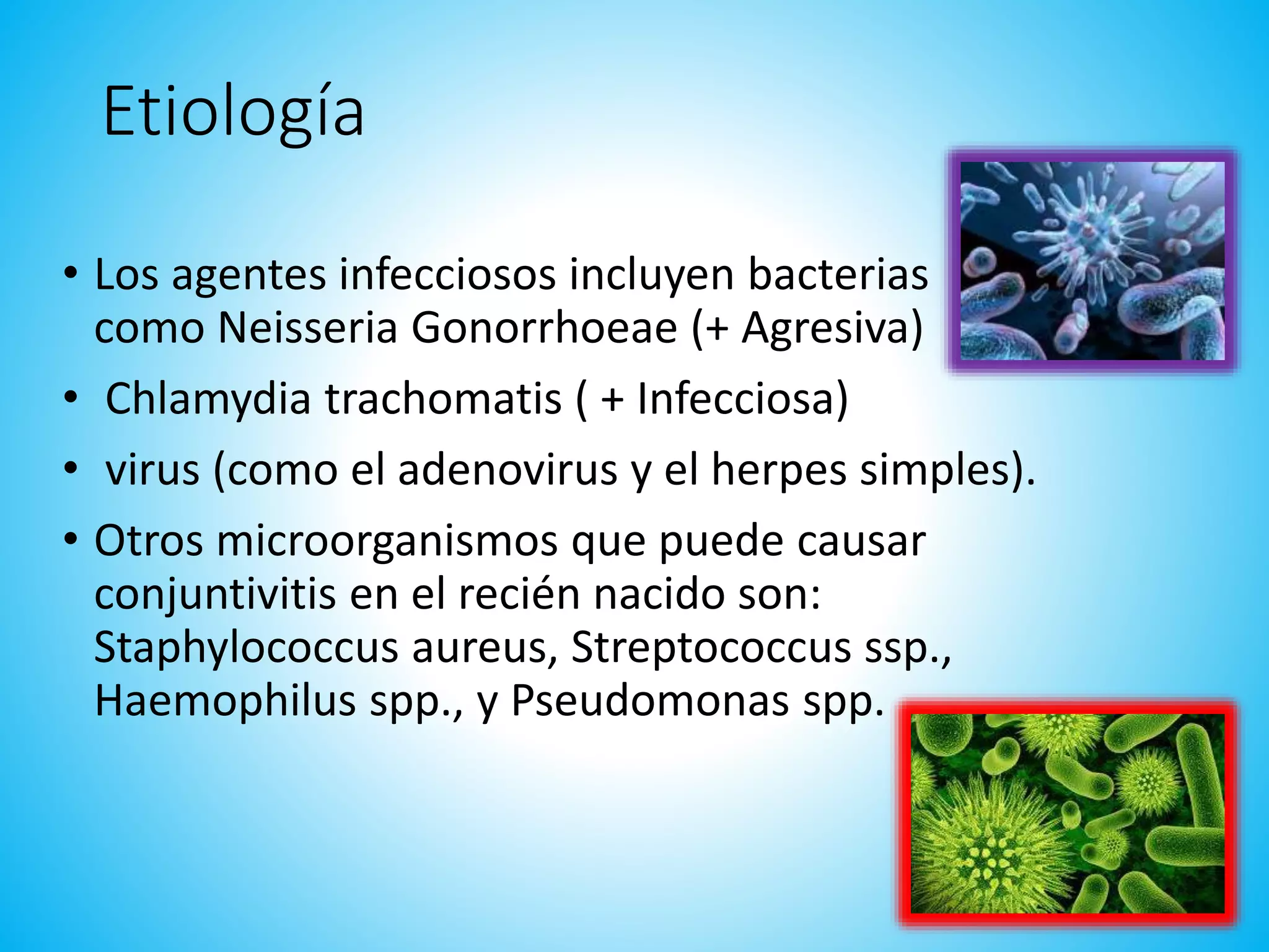 Conjuntivitis neonatal | PPTX