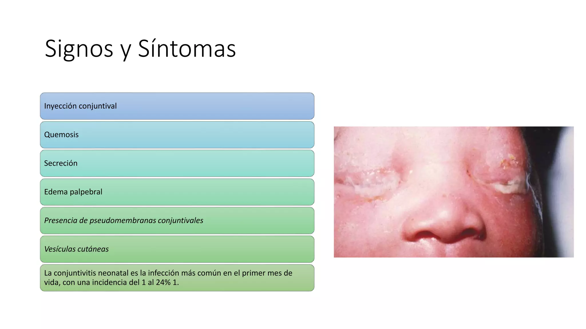 Conjuntivitis neonatal | PPT