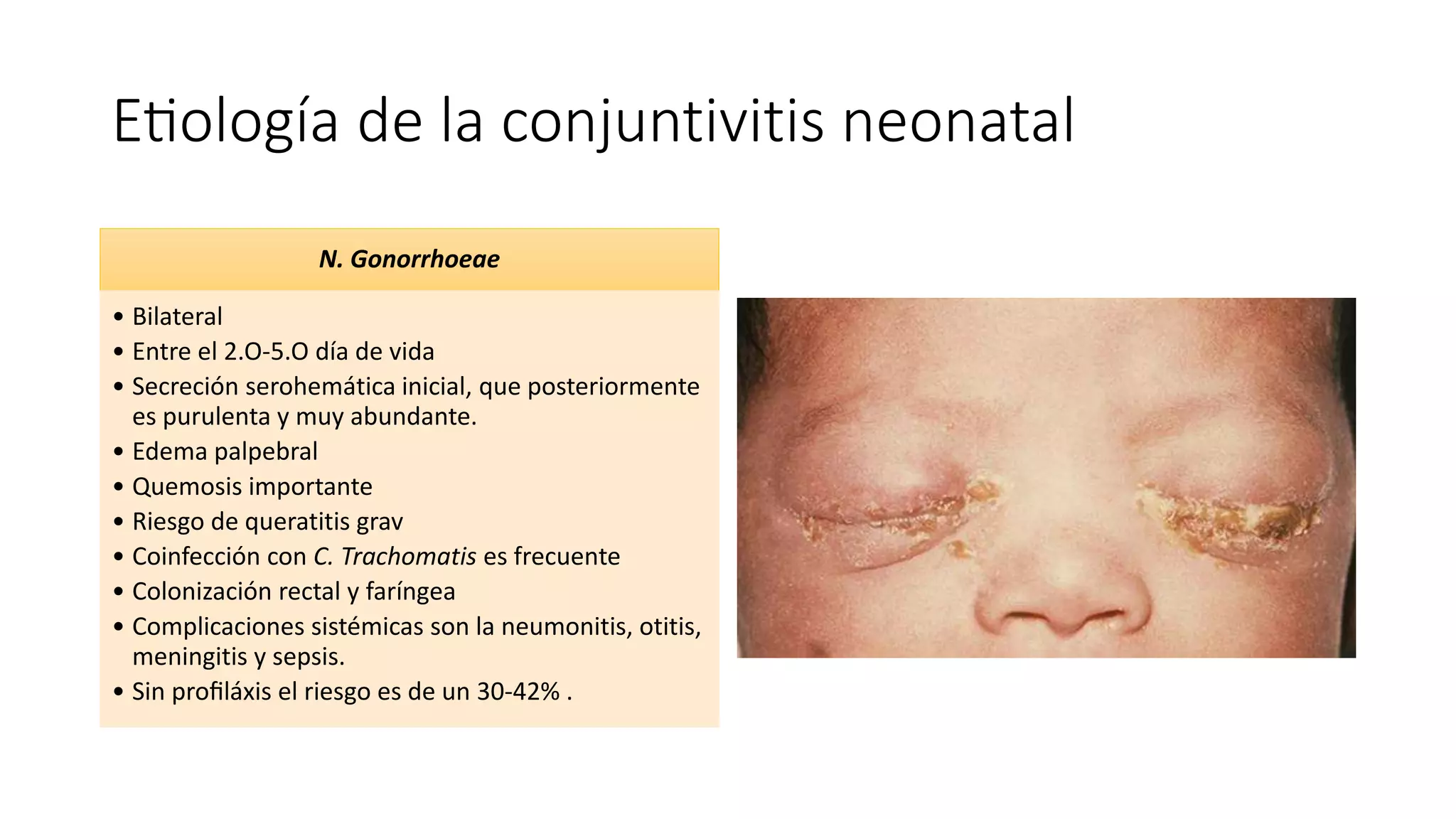 Conjuntivitis neonatal | PPT