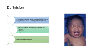 Conjuntivitis neonatal | PPTX