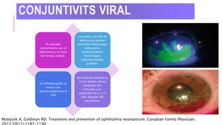 CONJUNTIVITIS NEONATAL | PPTX
