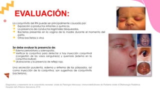 CONJUNTIVITIS RECIEN NACIDO EXPOSICIIOON | PPTX