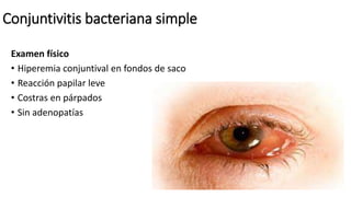 Conjuntivitis Viral, bact, alergica.pptx