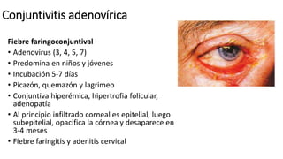 Conjuntivitis Viral, bact, alergica.pptx