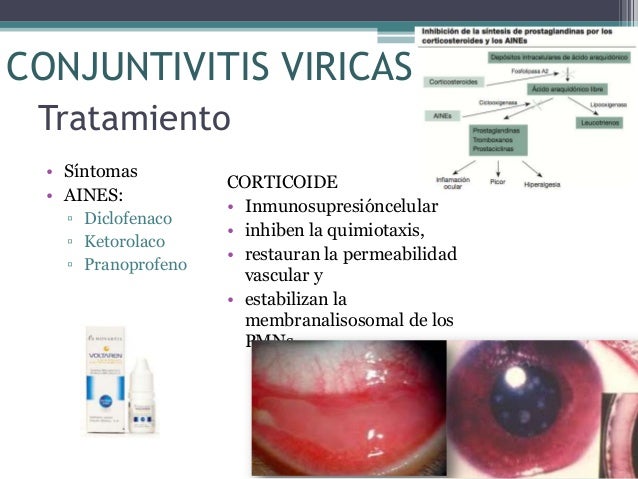 Conjuntivitis Viricas
