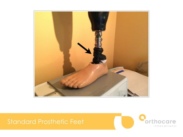 Connected prosthetics - Mark McWilliams | PPT