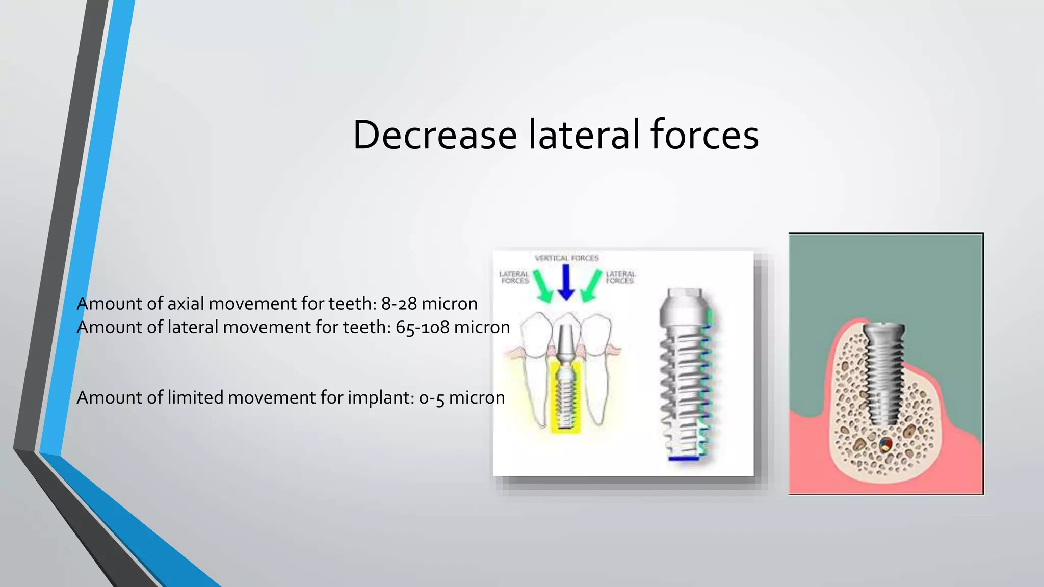 Implant splinting with natural tooth | PPTX