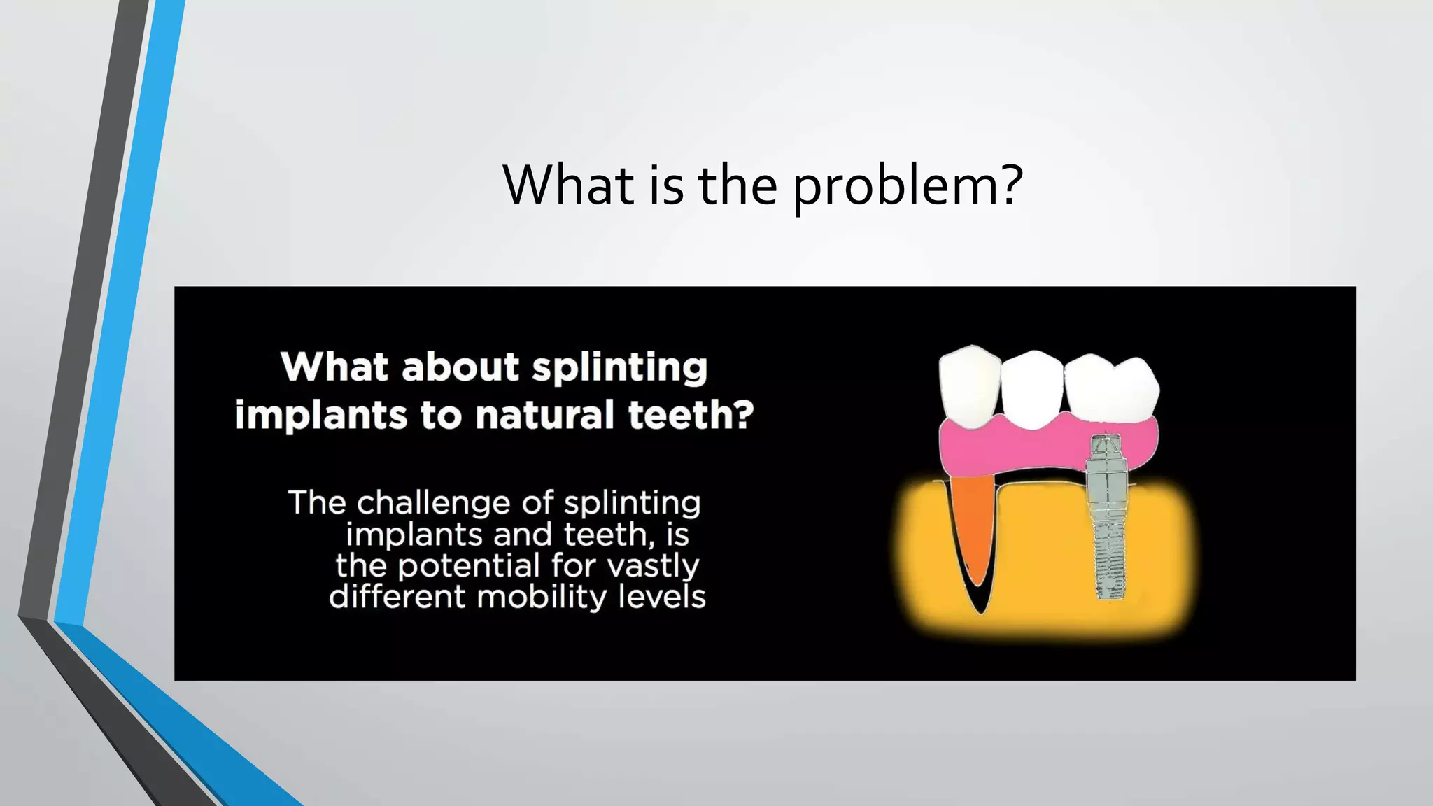 Implant splinting with natural tooth | PPTX