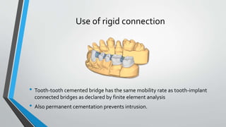 Implant splinting with natural tooth | PPTX | Dental Health | Diseases ...