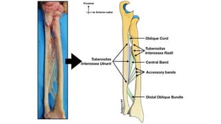 BIOMECHANICS OF CONNECTIONS AT ELBOW JOINT.pptx