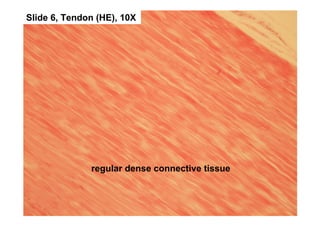Dense Connective Tissue Under Microscope