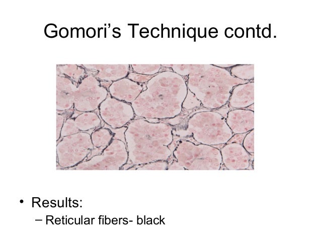 Connective tissue