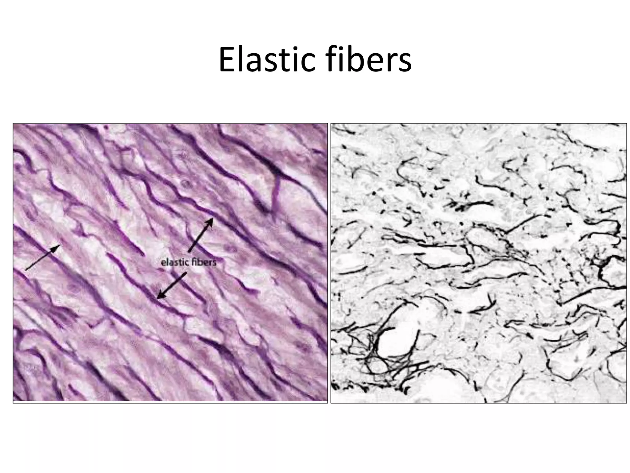 Connective tissue | PPTX