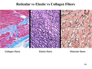 Reticular Fibers Vs Elastic Fibers