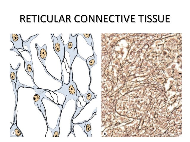 Reticular Tissue Labeled Reticular Tissue Labeled