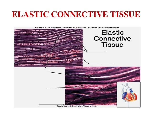 Connective tissue