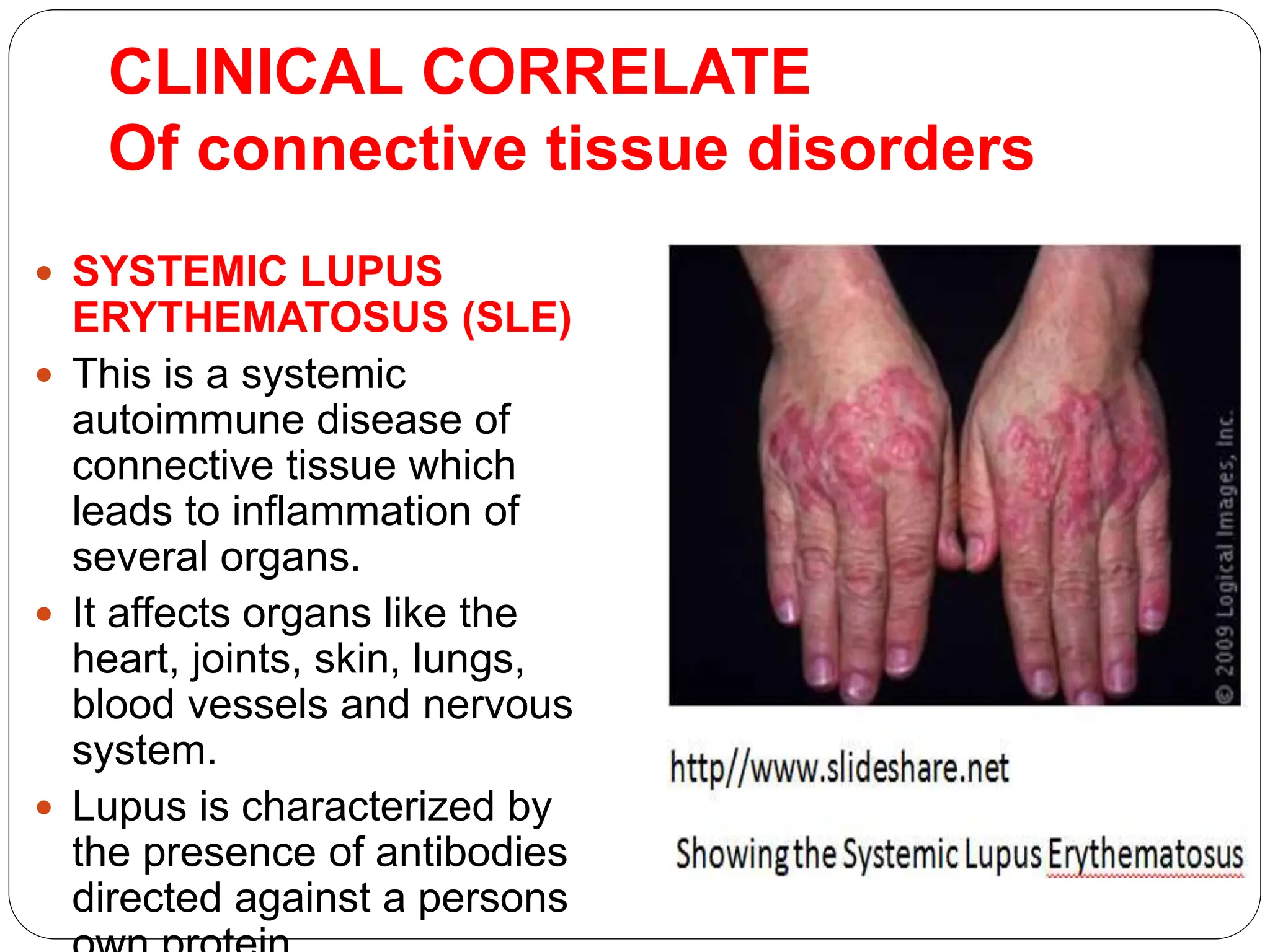 HISTOLOGY OF CONNECTIVE TISSUE IN ANATOMY | PPTX