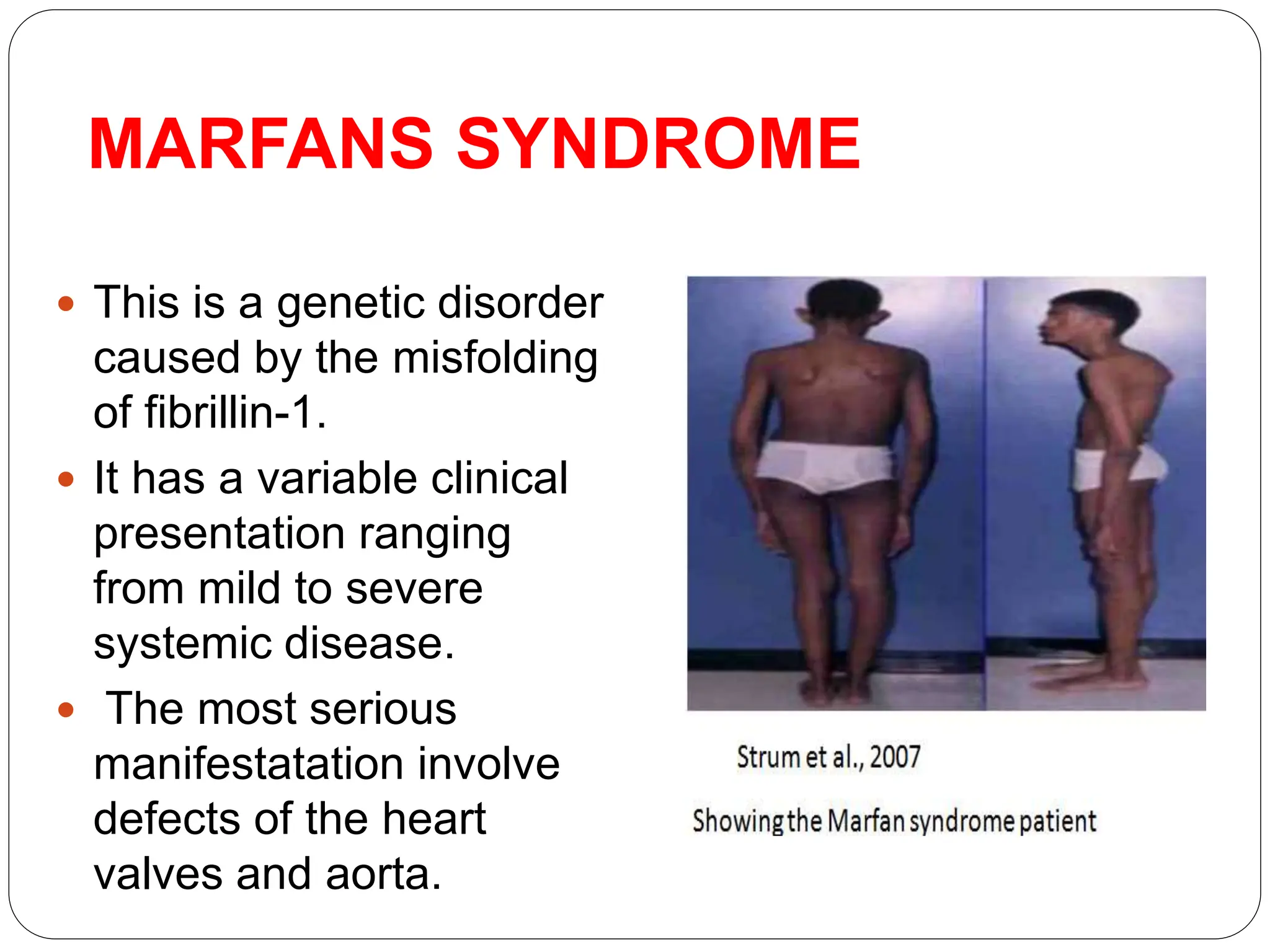 HISTOLOGY OF CONNECTIVE TISSUE IN ANATOMY | PPTX