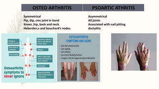 Connective tissue diorders | PPTX