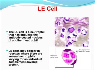 Connective tissue diseases (7) | PPT