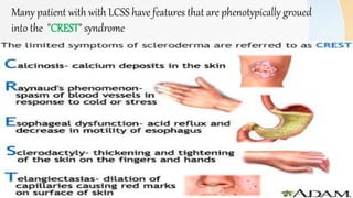 Connective tissue diseases | PPTX
