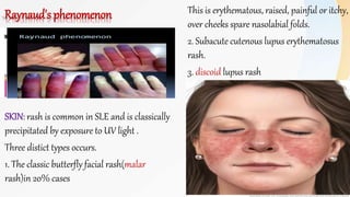 Connective tissue diseases | PPTX