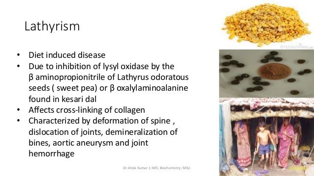 Connective tissue disorders by Dr Ashok Kumar J