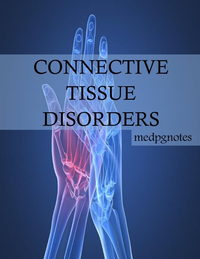 Connective Tissue Disorders Sample Connective Tissue Disorders Sample