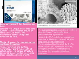 Connective tissue grafts | PPTX