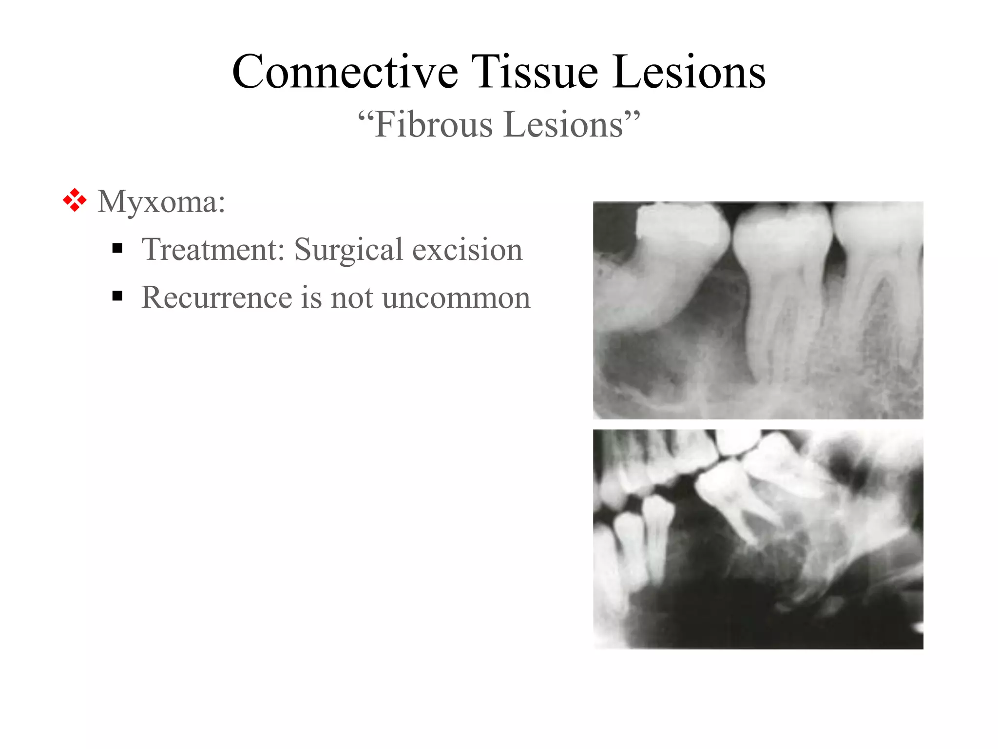Connective tissue lesions | PDF