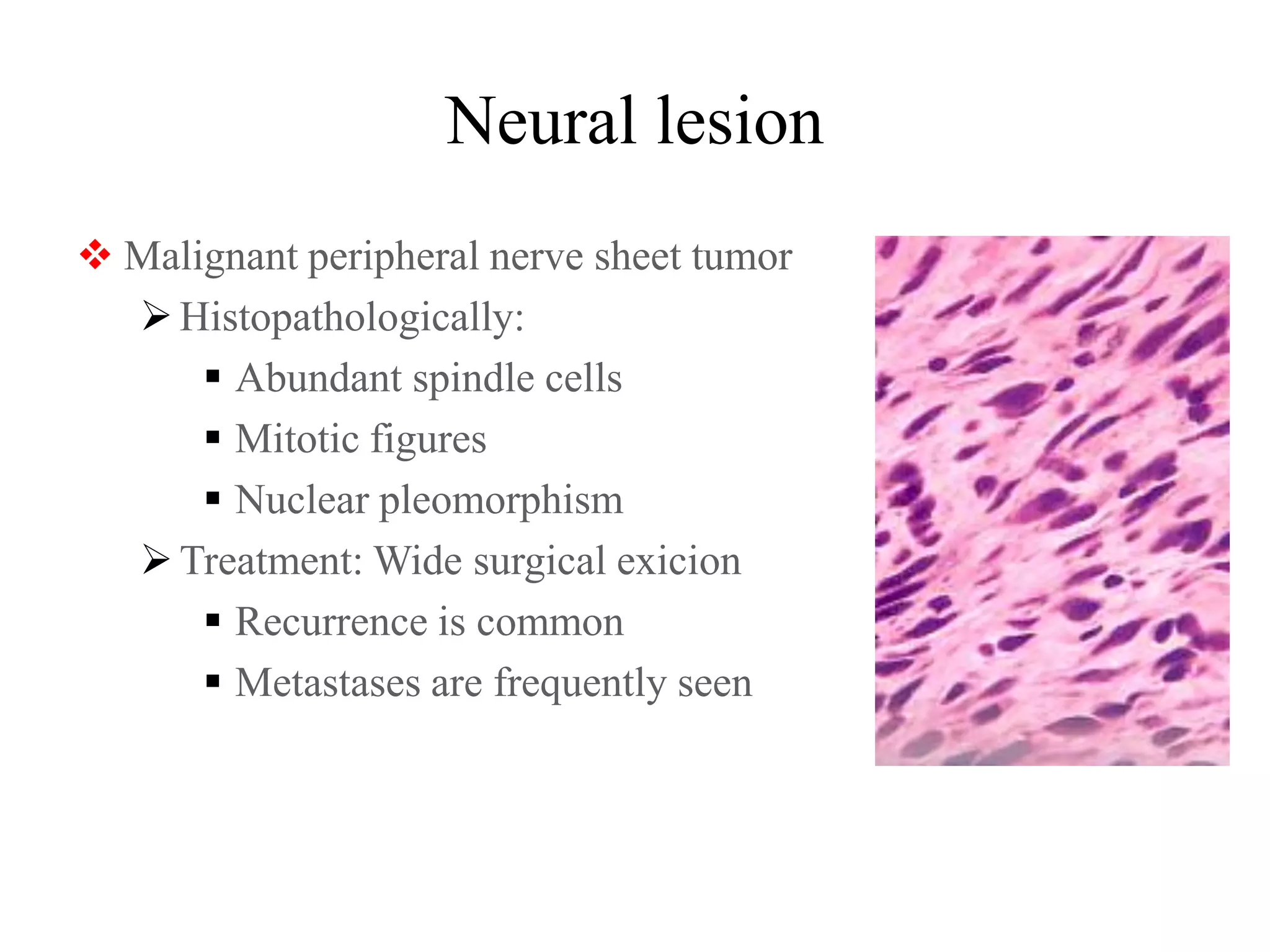 Connective tissue lesions | PDF