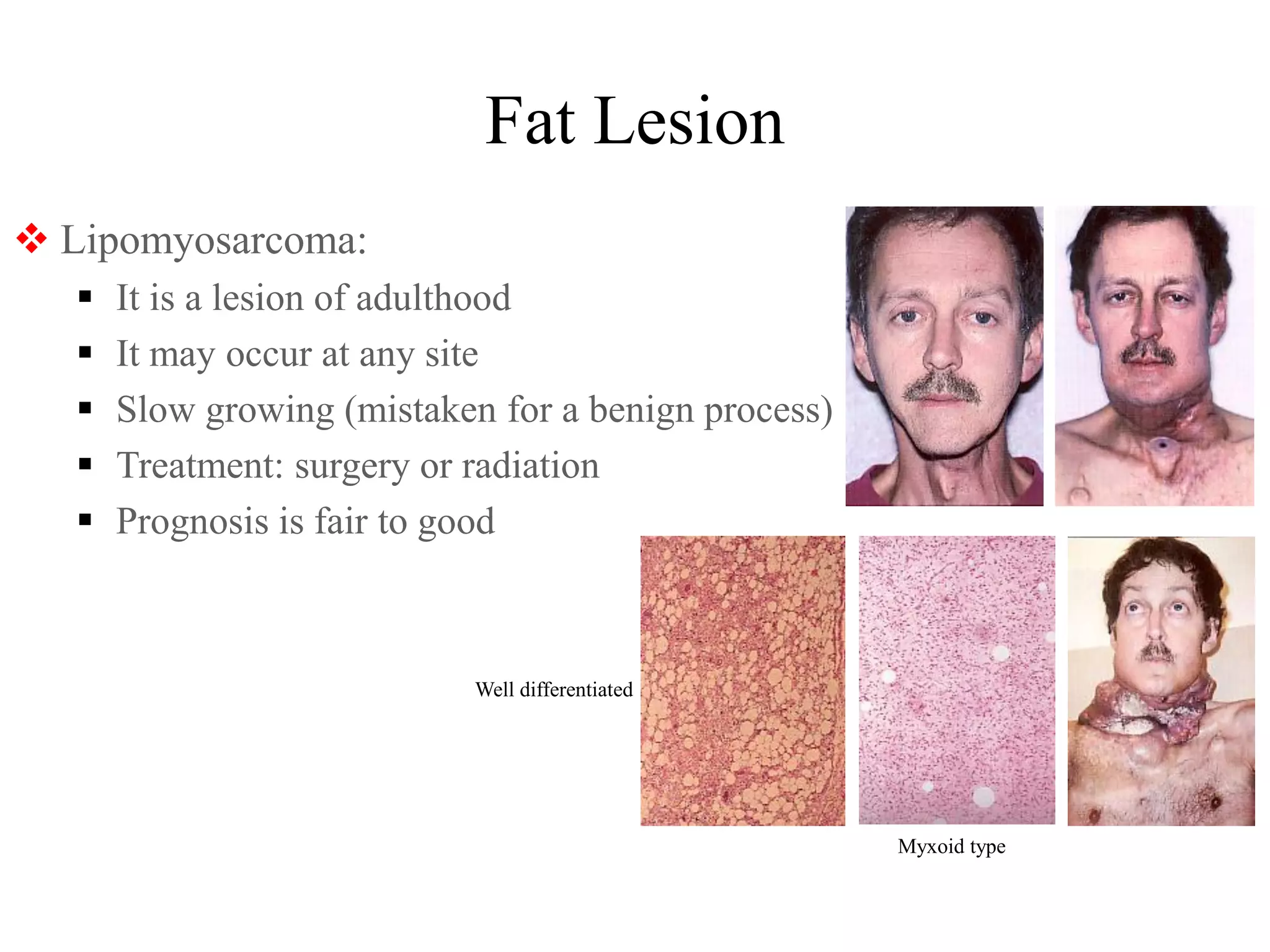 Connective tissue lesions | PDF