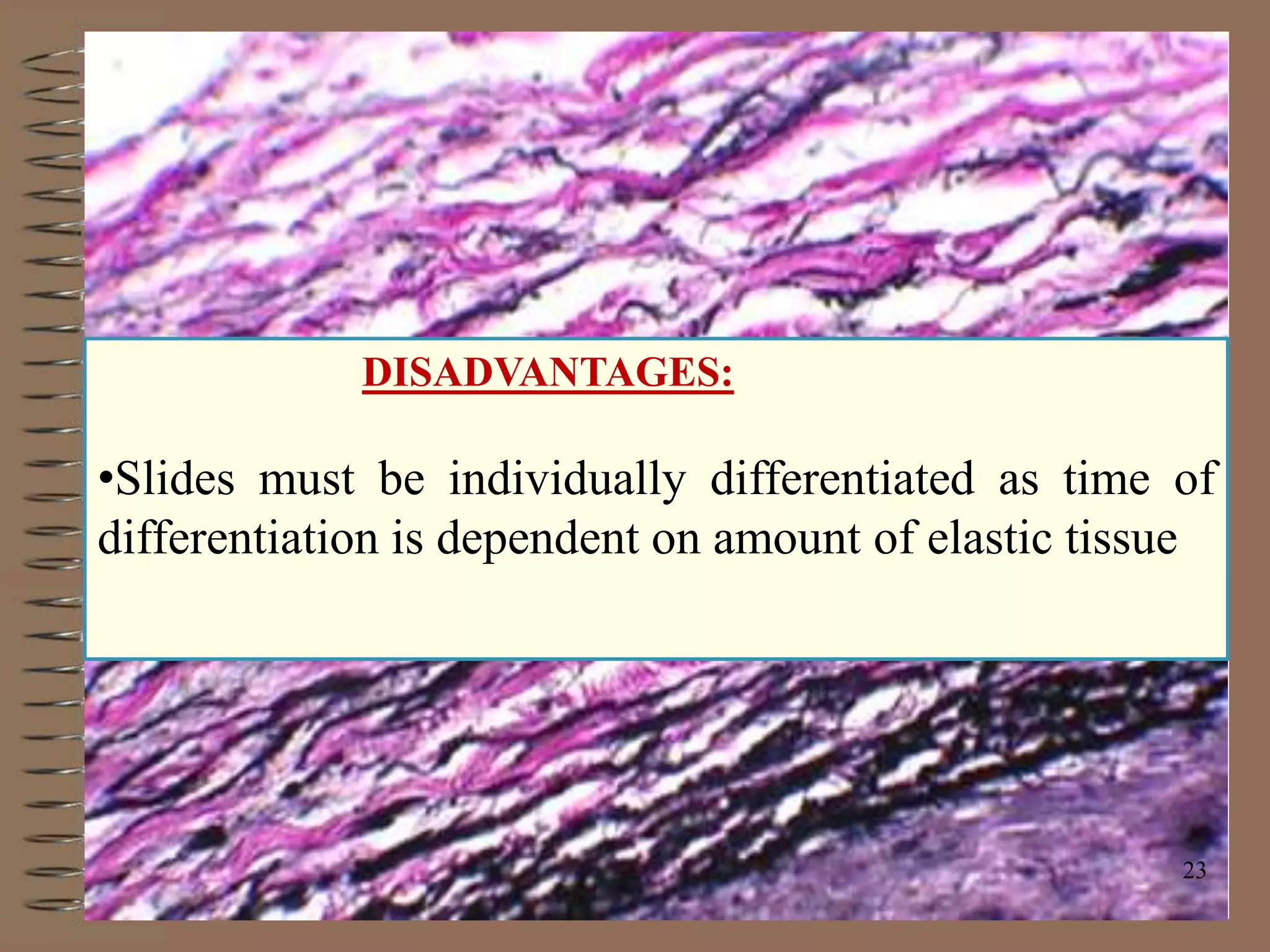 CONNECTIVE TISSUE STAINS | PPTX