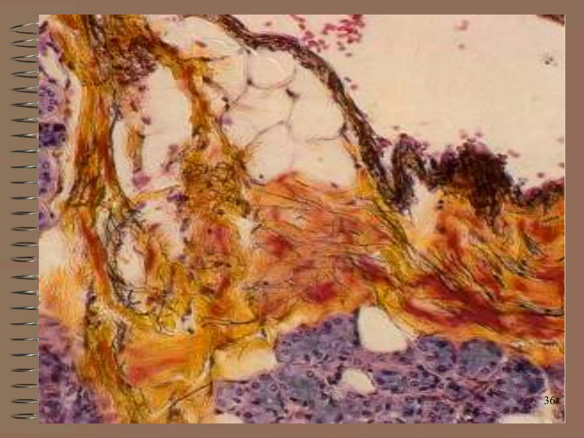 CONNECTIVE TISSUE STAINS | PPTX