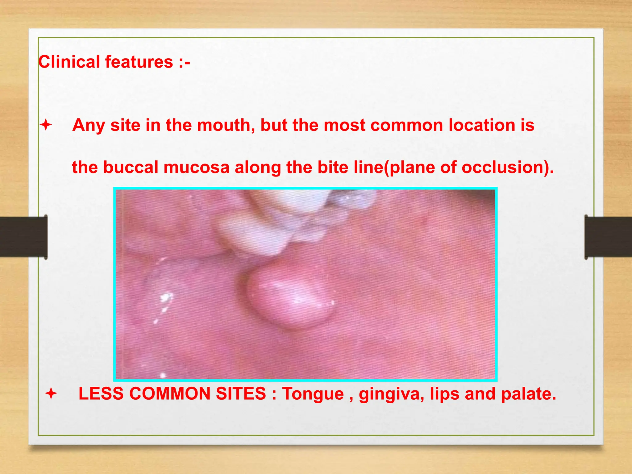 Connective tissue tumors-Benign for 3rd bds.ppt