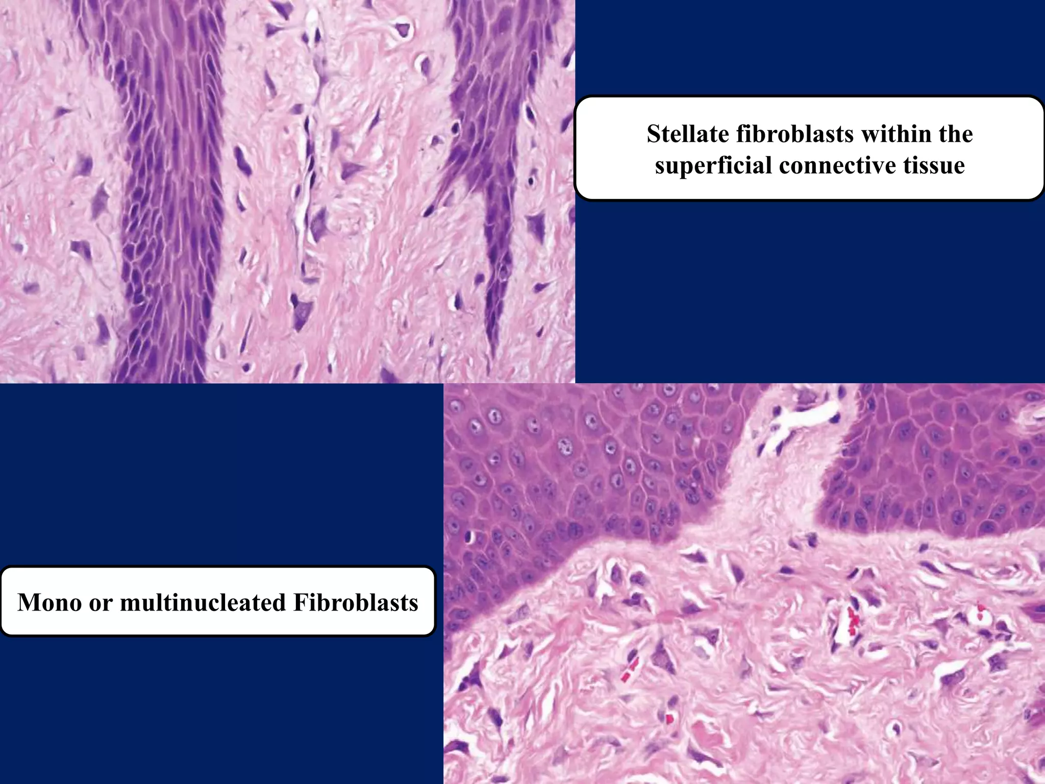 benign and malignant tumors of connective tissue origin | PPTX