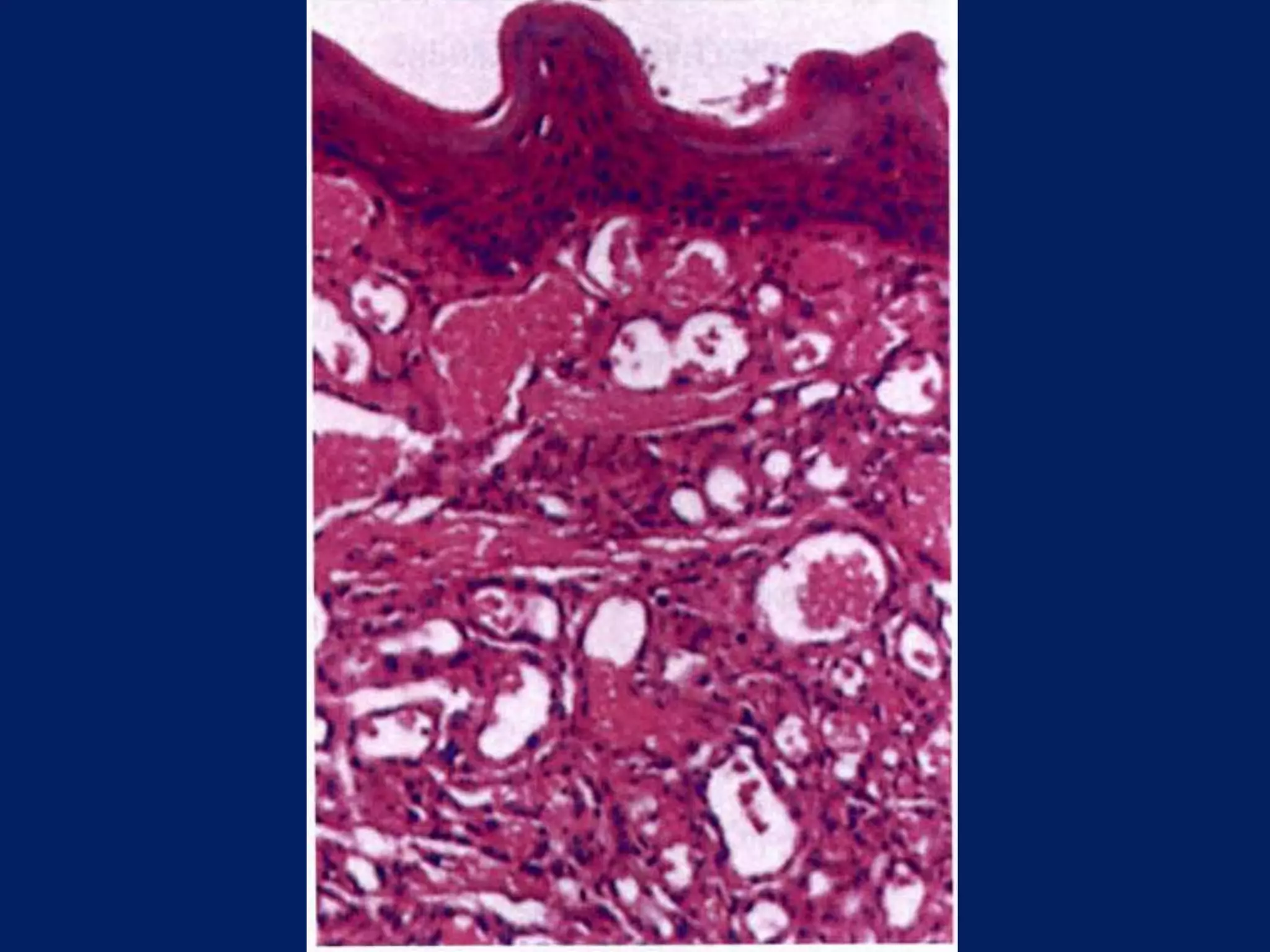 benign and malignant tumors of connective tissue origin | PPTX
