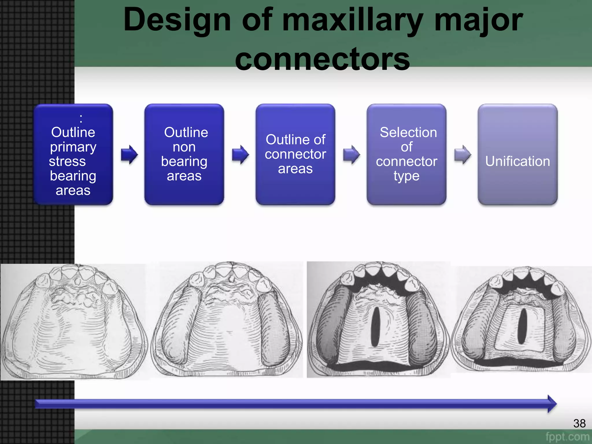 Major Connectors | PPTX | Dental Health | Diseases and Conditions