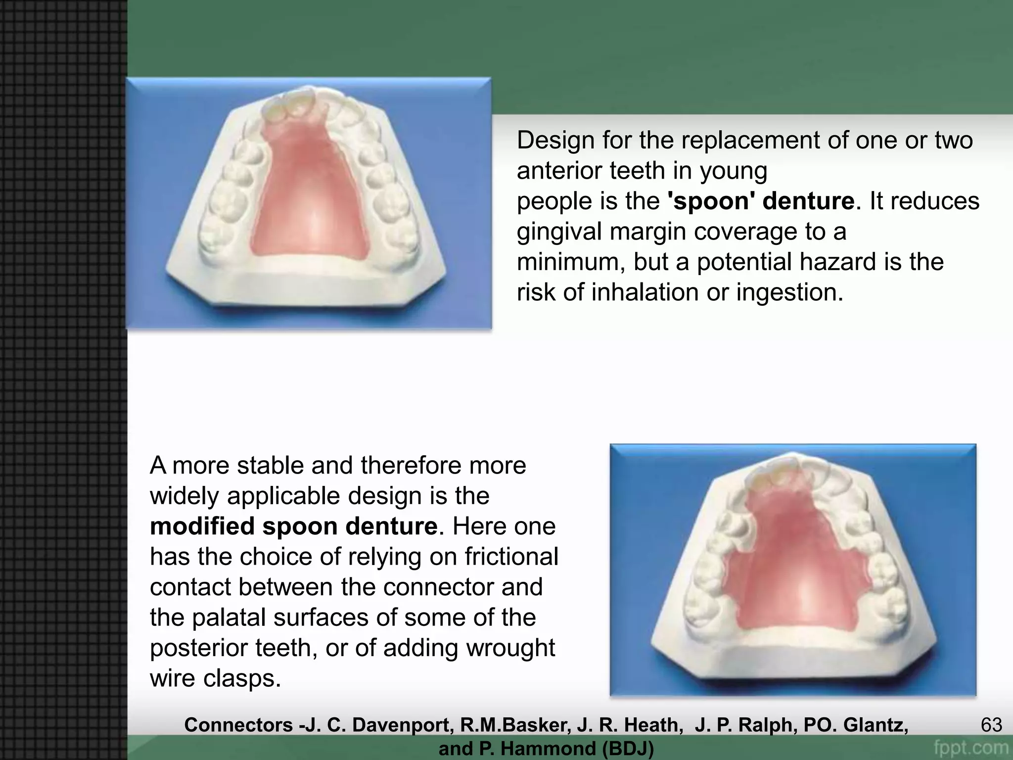 Major Connectors | PPTX